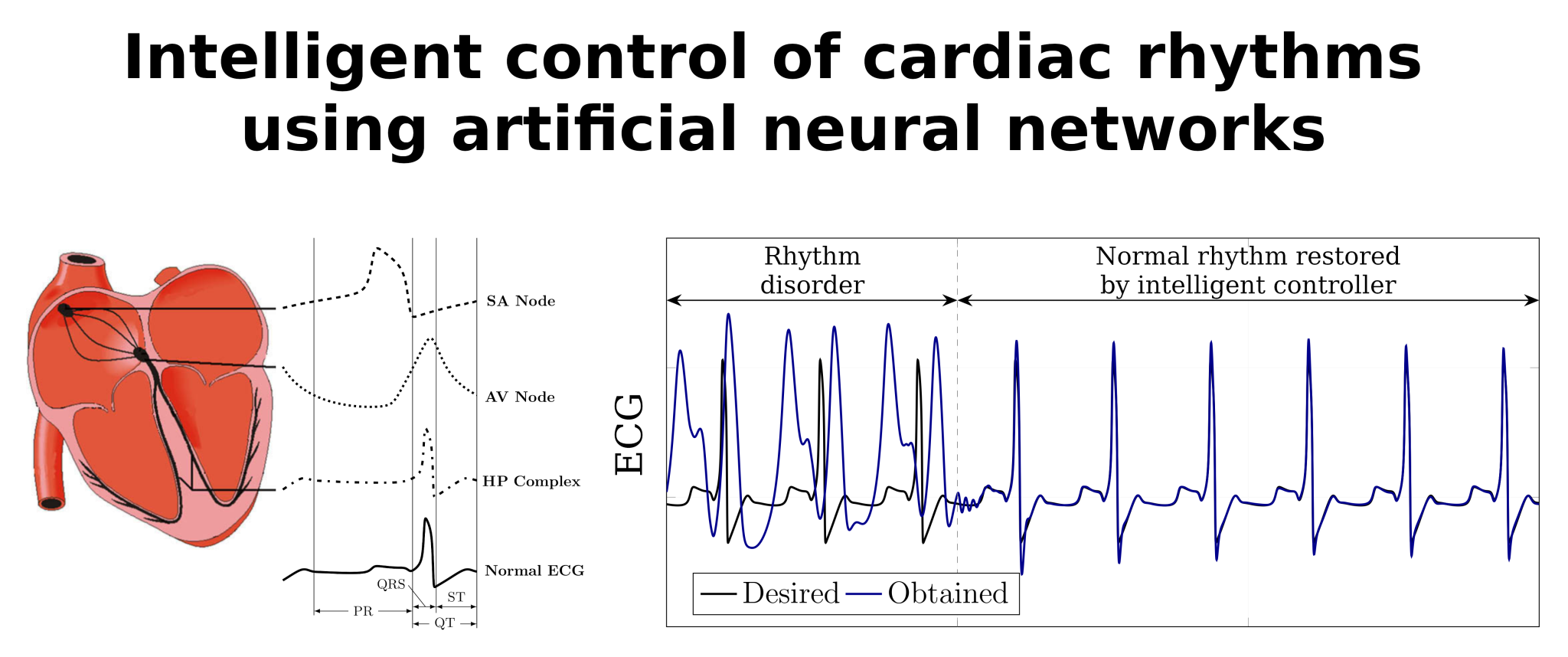 Intelligent control of cardiac rhythms | Smart Systems